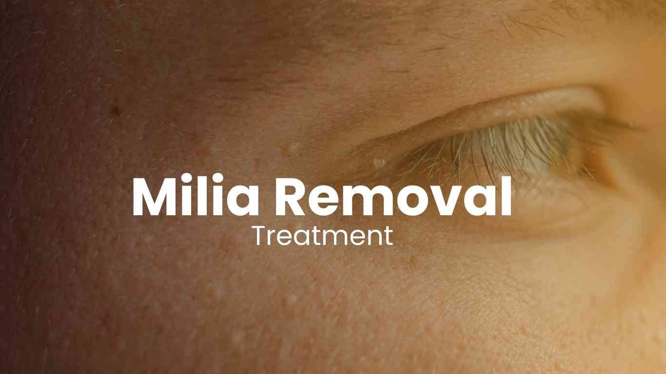 Best Milia Removal In Singapore - Dr Plus Clinic